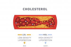Lipidogram – jak interpretować cholesterol całkowity, LDL i HDL